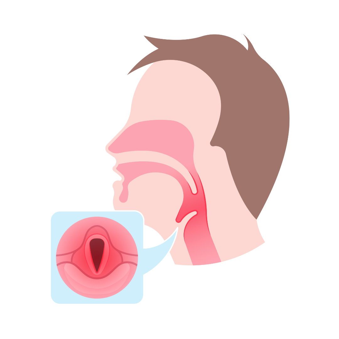 Pharyngitis - body support, natural supplements and prevention